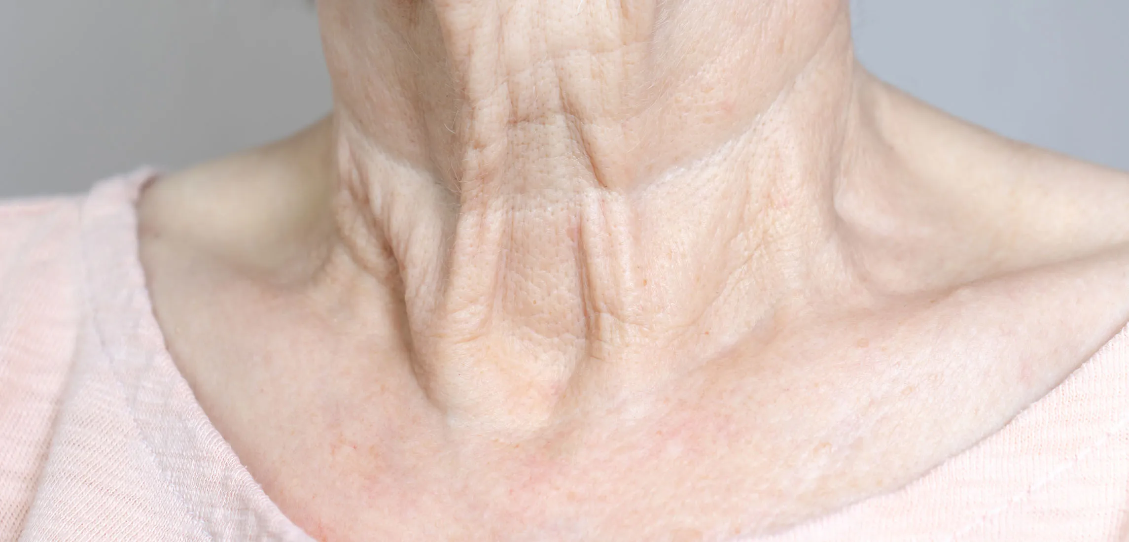 Neck cords: Causes, Prevention, and Treatment Options Available