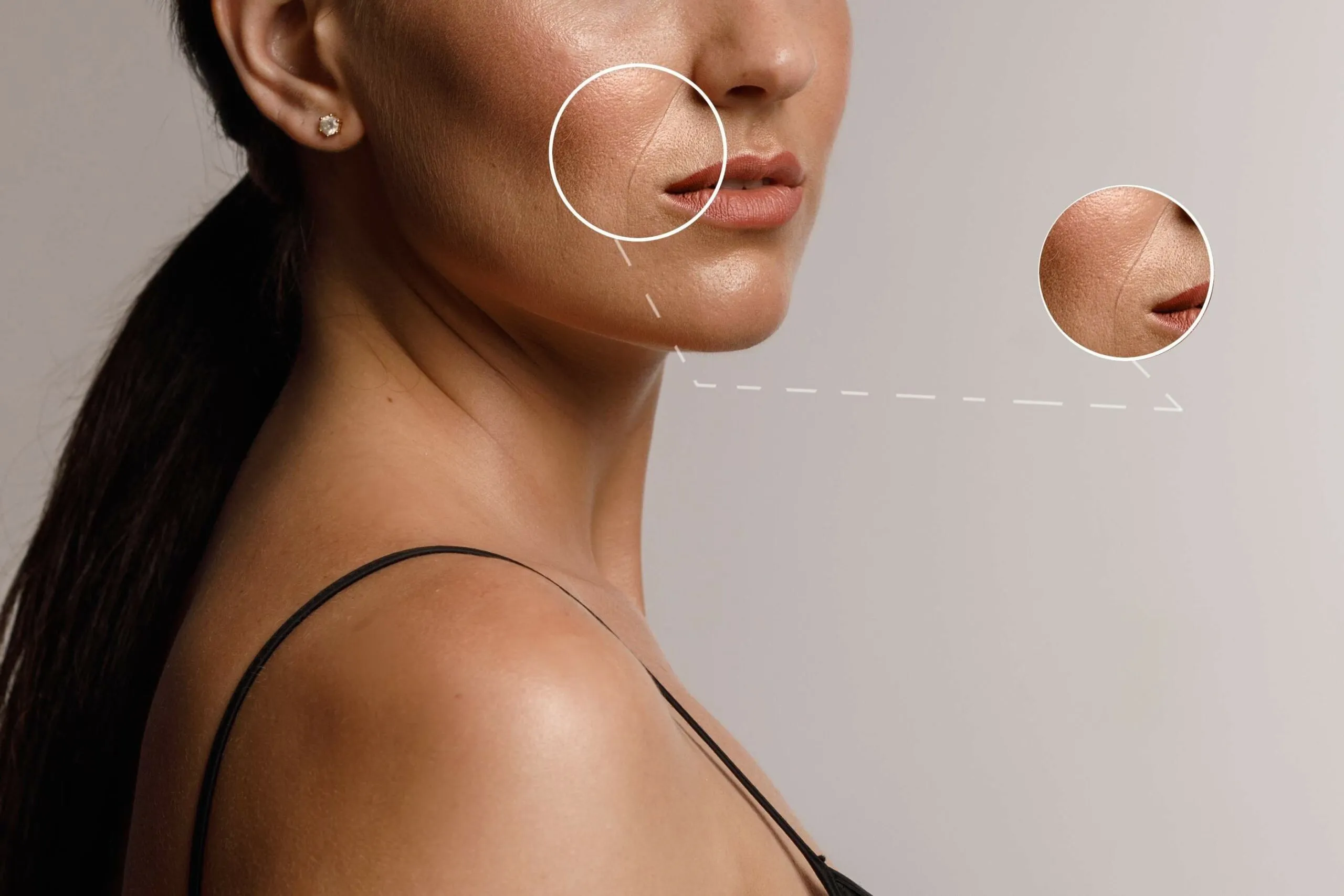 Treat Smile Lines | Anti-Aging Medical & Laser Clinic