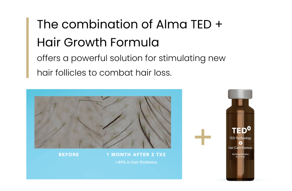 Say goodbye to hair loss and frustration with outdated methods