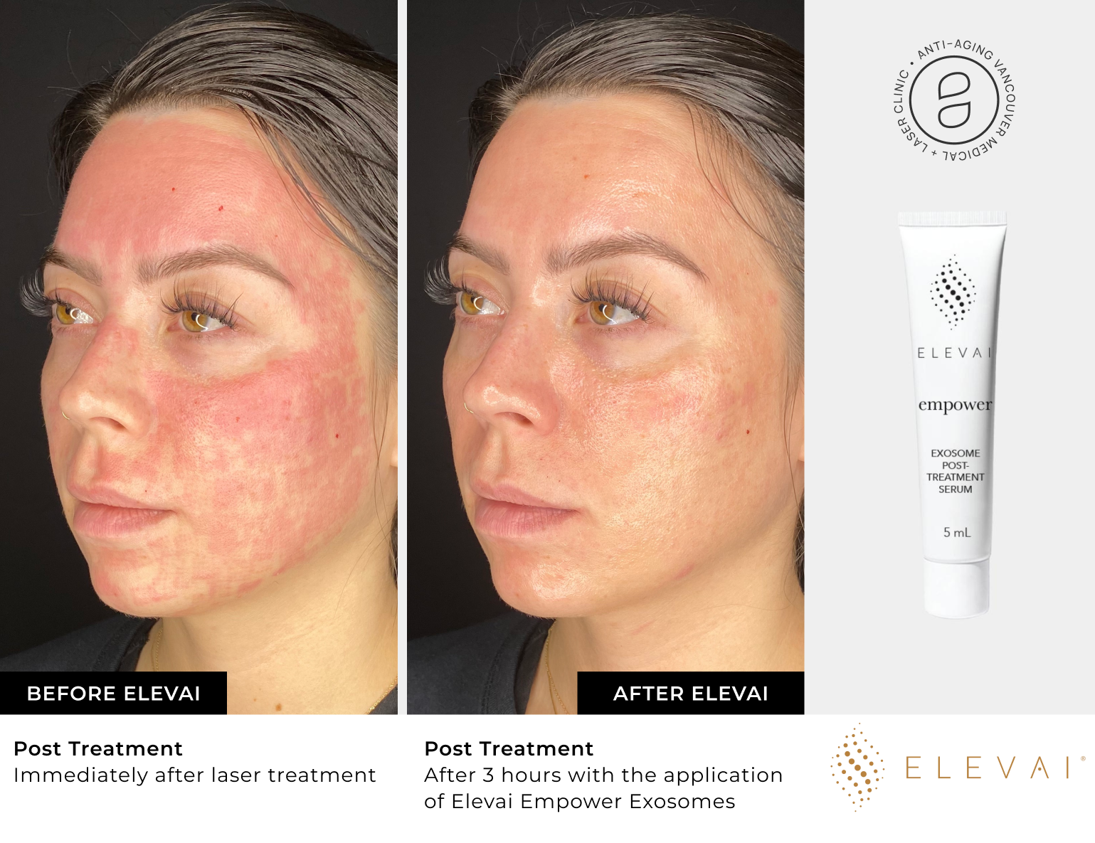 Cosmetic Treatments Laser Treatments: Enhancing Your Skin Care