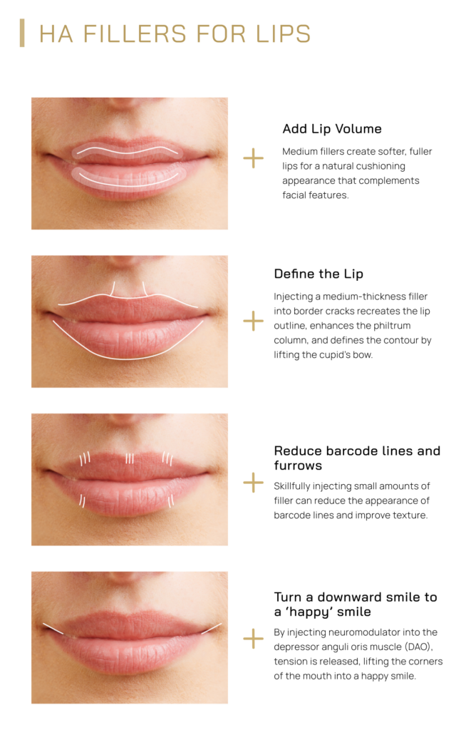 Cosmetic Treatments Transform Your Lips with Lip Enhancement Techniques